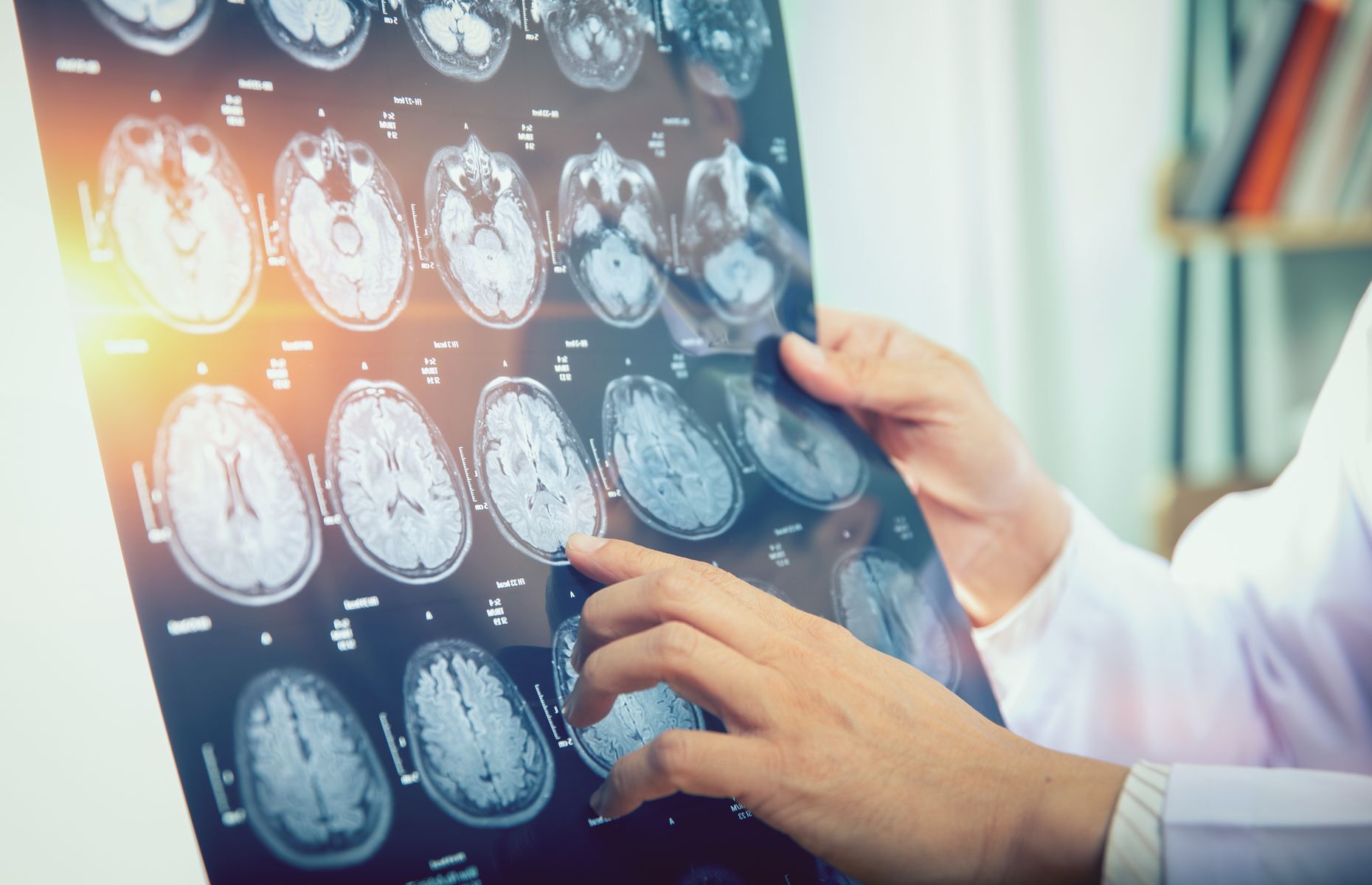 Aphasie : comment reconnaître les premiers signes