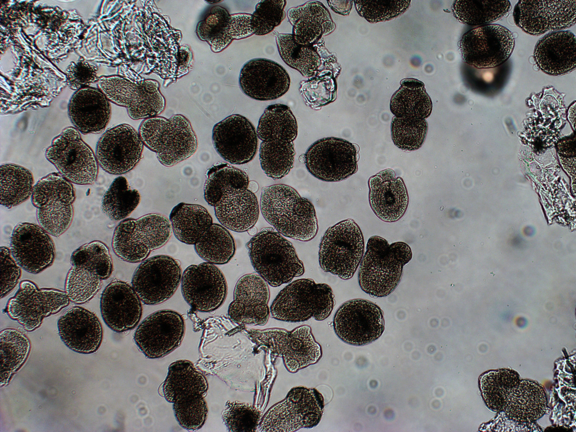 30 maladies parasitaires qui vont vous faire frissonner