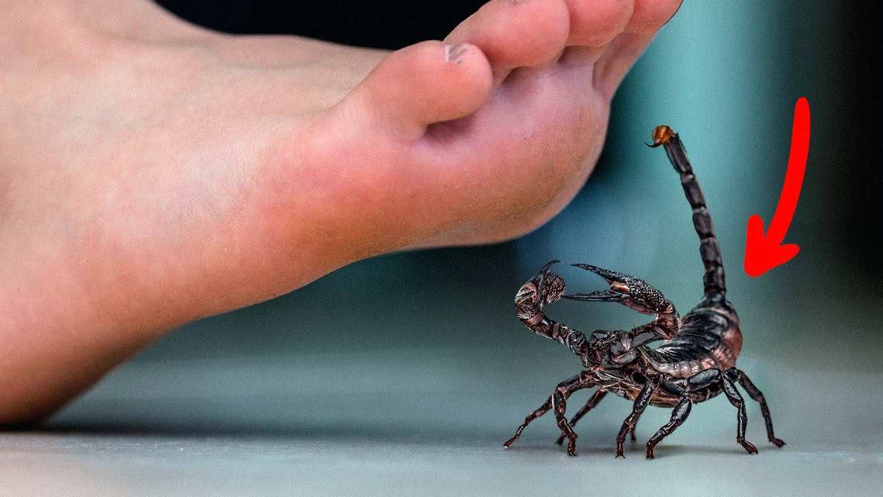 What you need to know to survive a deadly scorpion sting