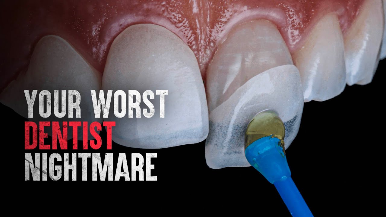 How to survive the most painful dental procedures