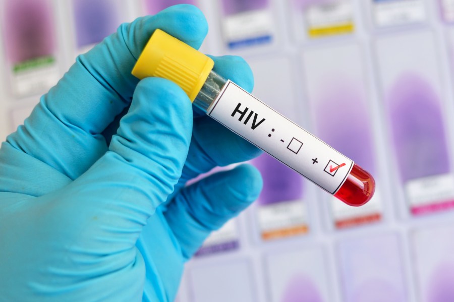 Shelby County Health Dept. starts at-home HIV testing program