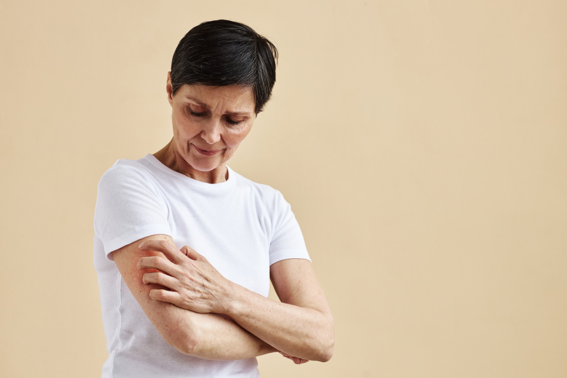 How serious is skin picking disorder?