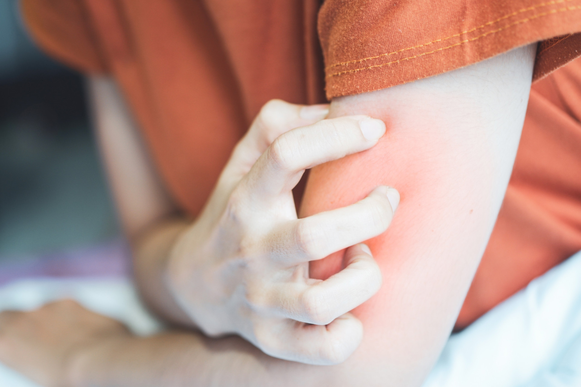 How serious is skin picking disorder?