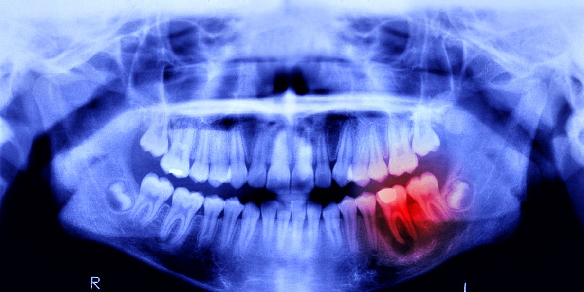 Humans May Be Able to Grow New Teeth Within Just 5 Years