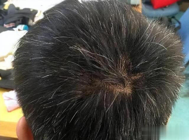 人能活多久看头发就知道？医生：寿命长的人，头发会有这些特征
