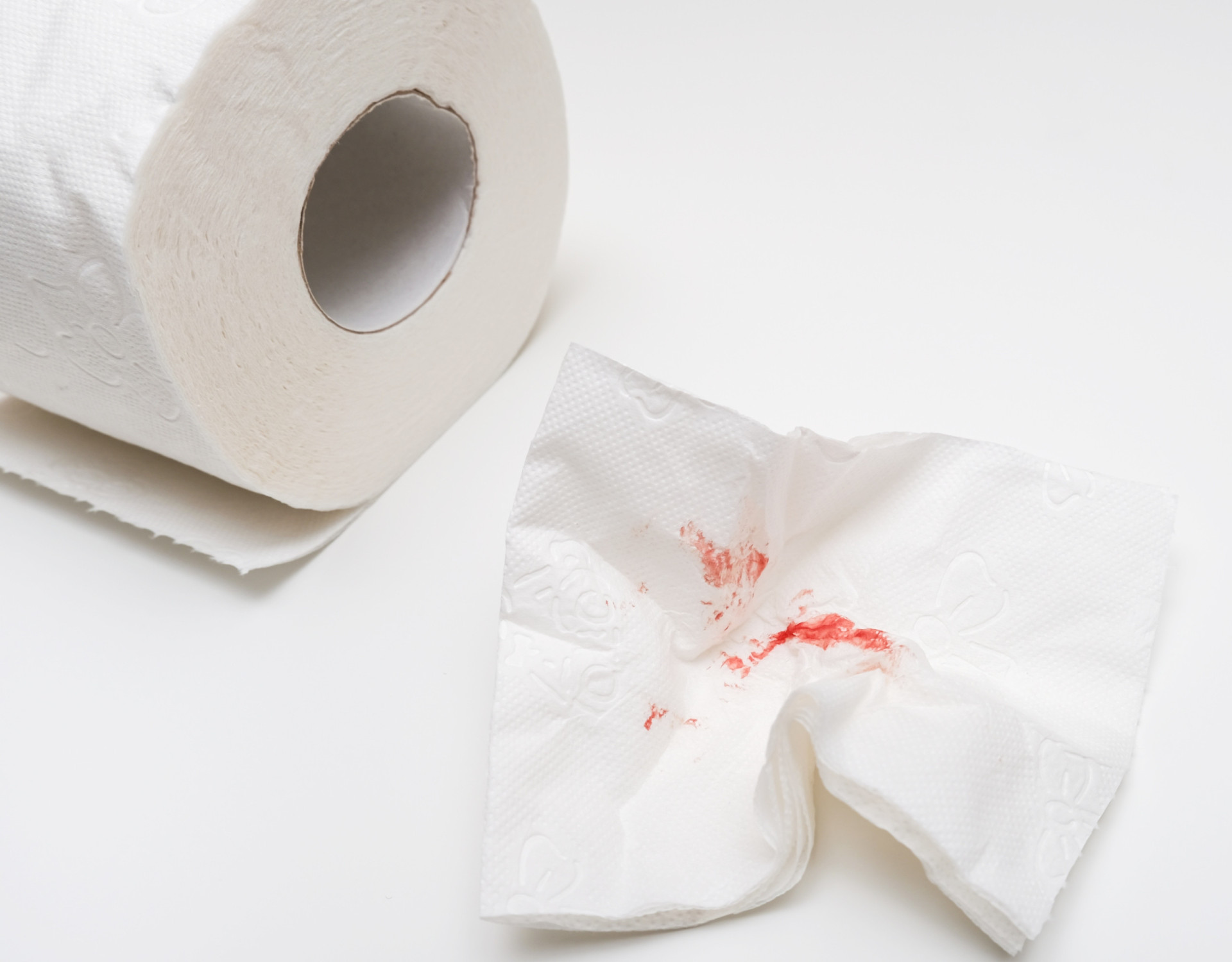 Inflammatory bowel disease: symptoms, causes, and everything else you ...