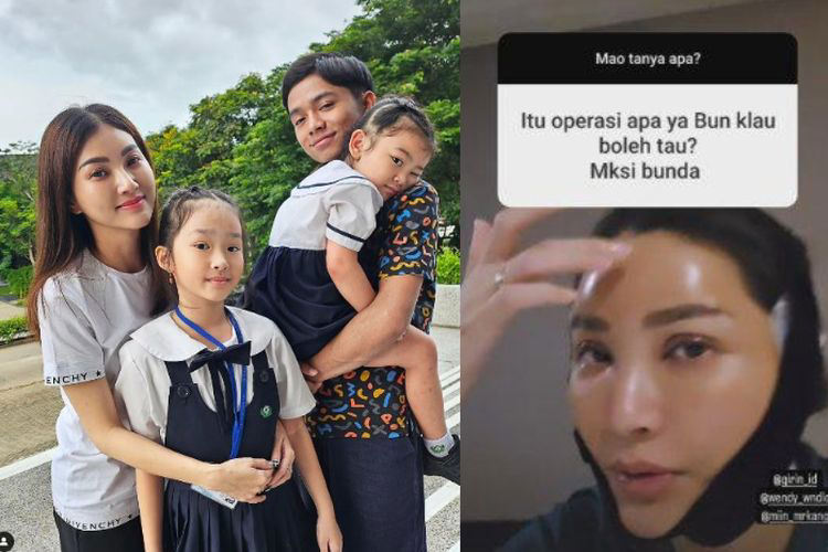 Wajahnya Masih Bengkak Usai Oplas, Sarwendah Justru Boyong Anak-anaknya ... Wajahnya Masih Bengkak Usai Oplas, Sarwendah Justru Boyong Anak-anaknya ...