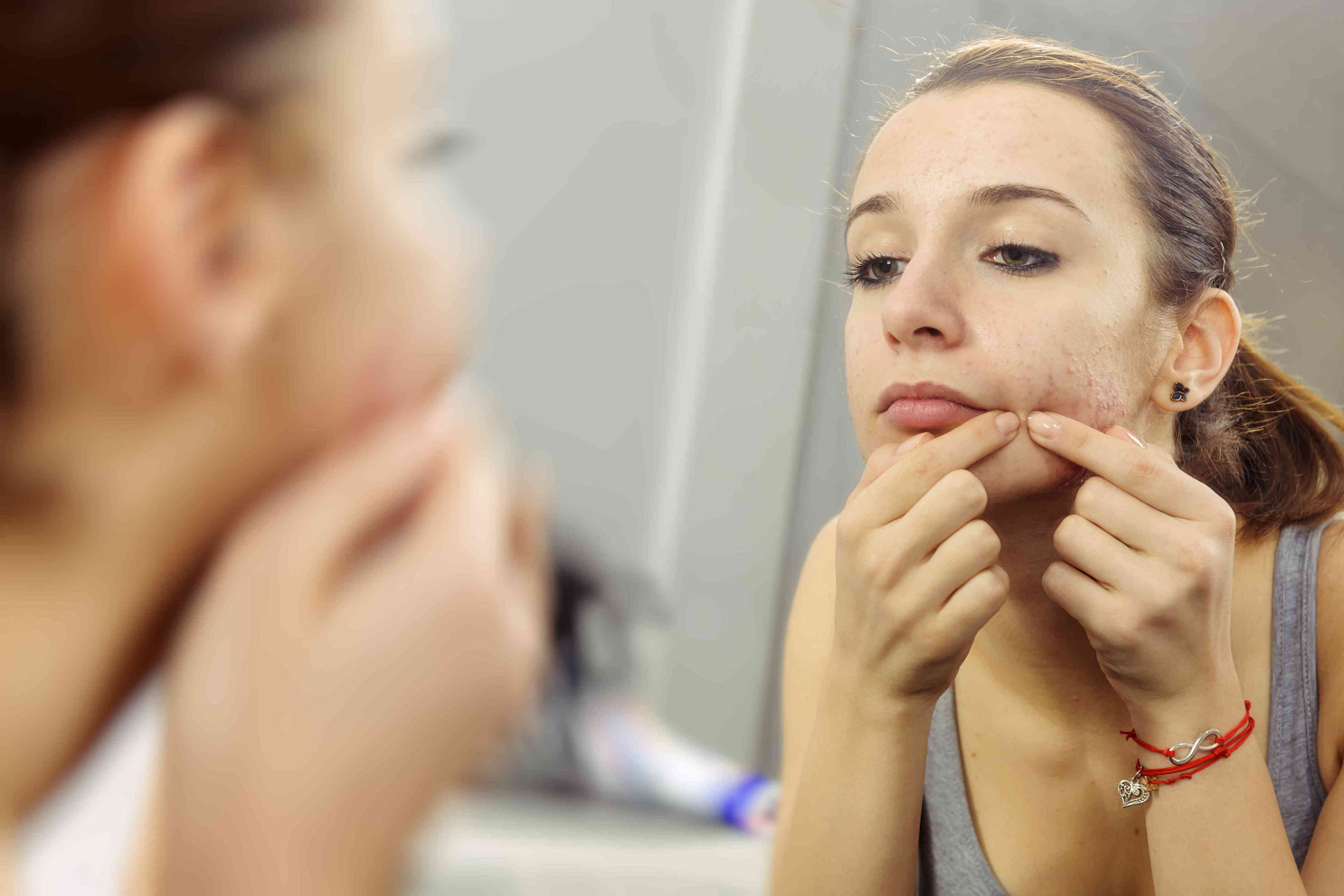 8 reasons why you have red dots on your skin