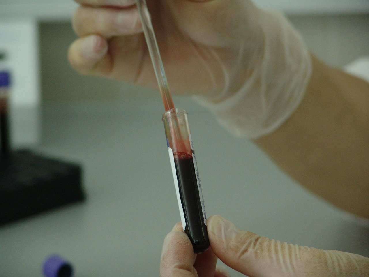 Multiple man-made 'forever chemicals' found in 98.5% of people tested