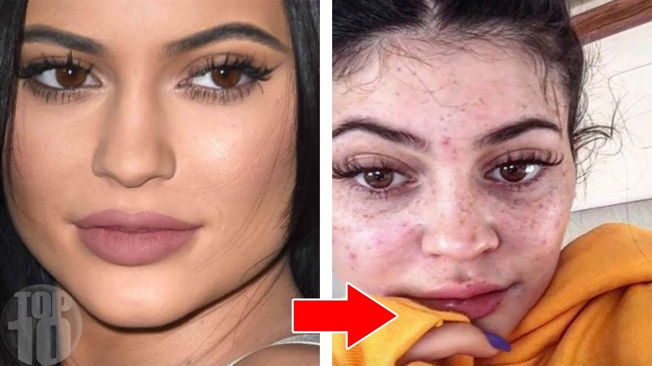 Epic Reactions - MSN