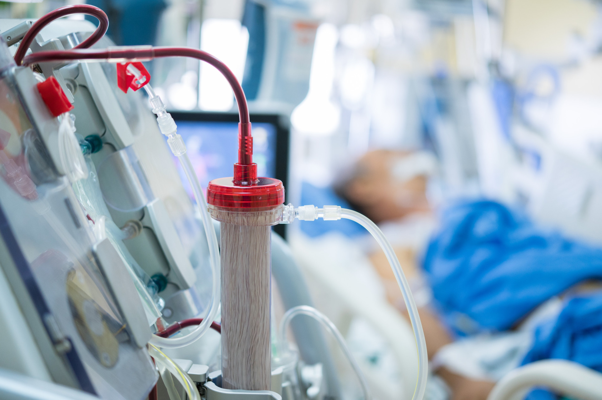 Czym właściwie jest amyloidoza?