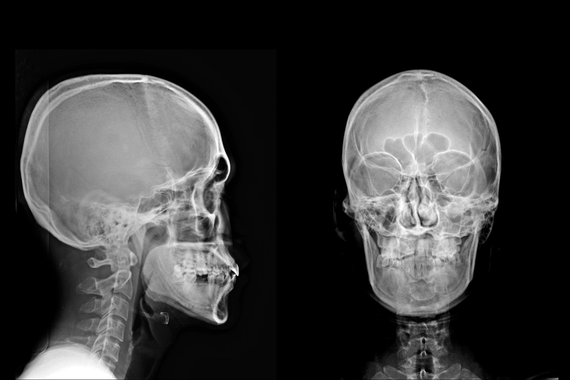 The rarest causes of death in the world