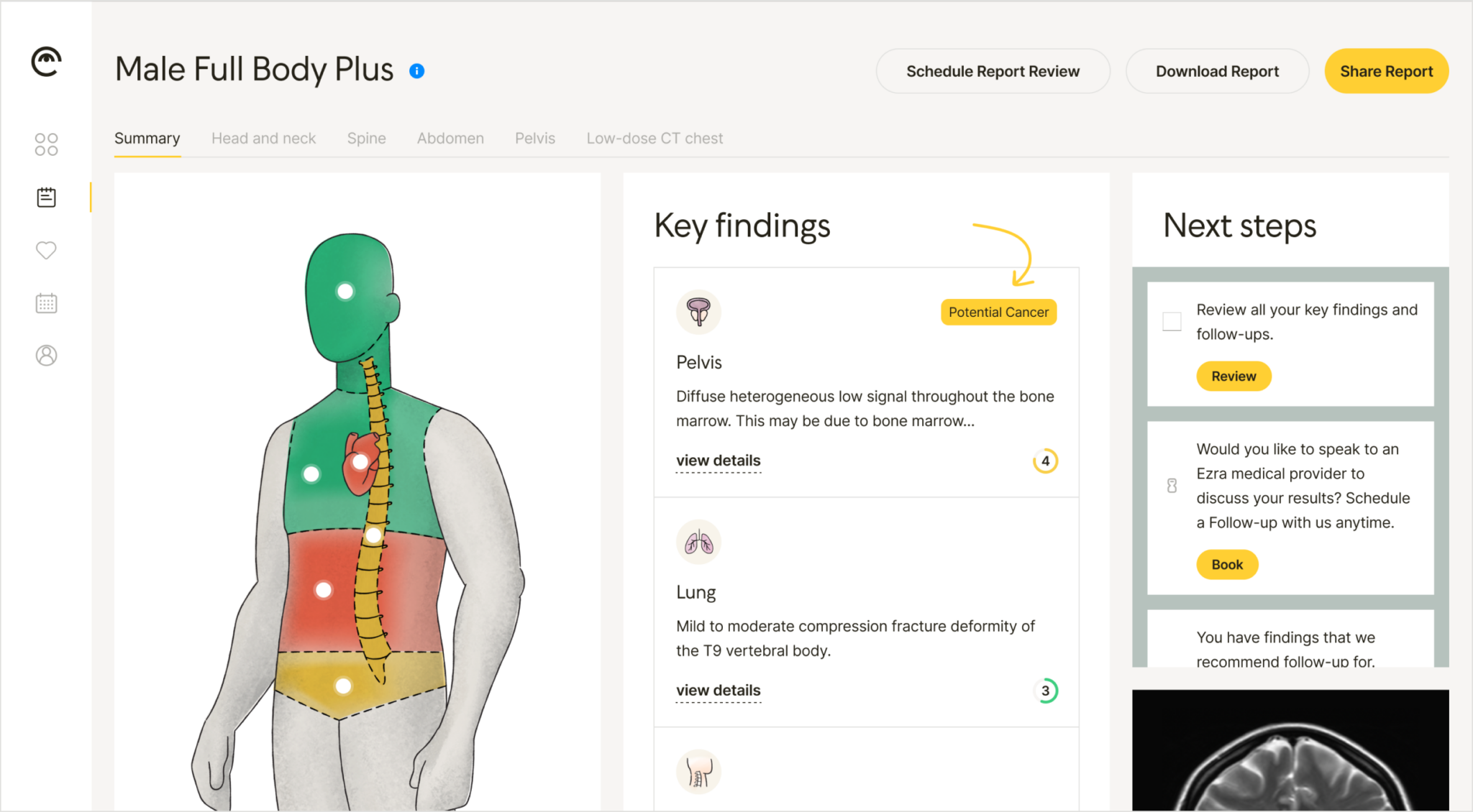 Cancer screening tech startup Ezra opens two locations in Seattle area Cancer screening tech startup Ezra opens two locations in Seattle area
