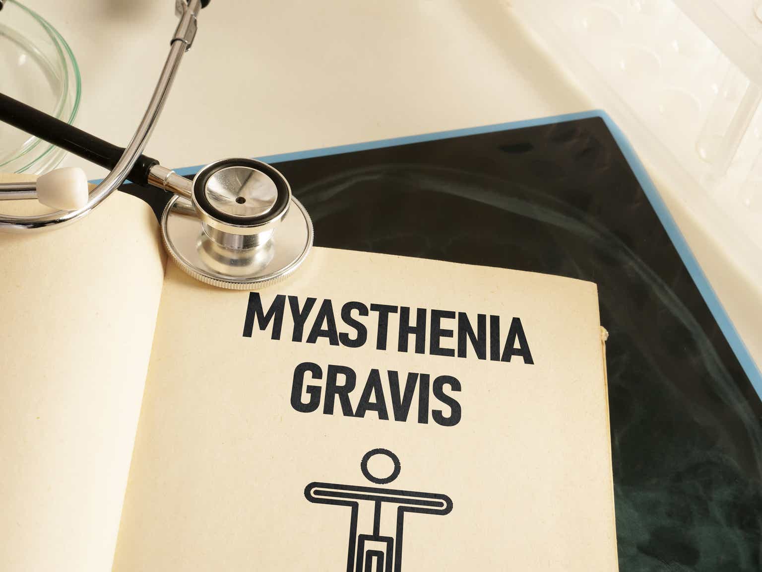 Regeneron myasthenia gravis therapy undergoes US and EU review