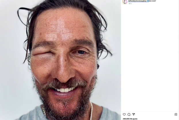 El raro accidente de Matthew McConaughey que él se ha tomado con humor El raro accidente de Matthew McConaughey que él se ha tomado con humor