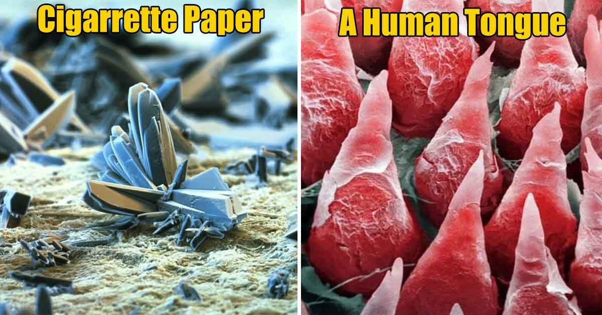 Tiny Terrors: 23 Things That Look Horrifying Under a Microscope