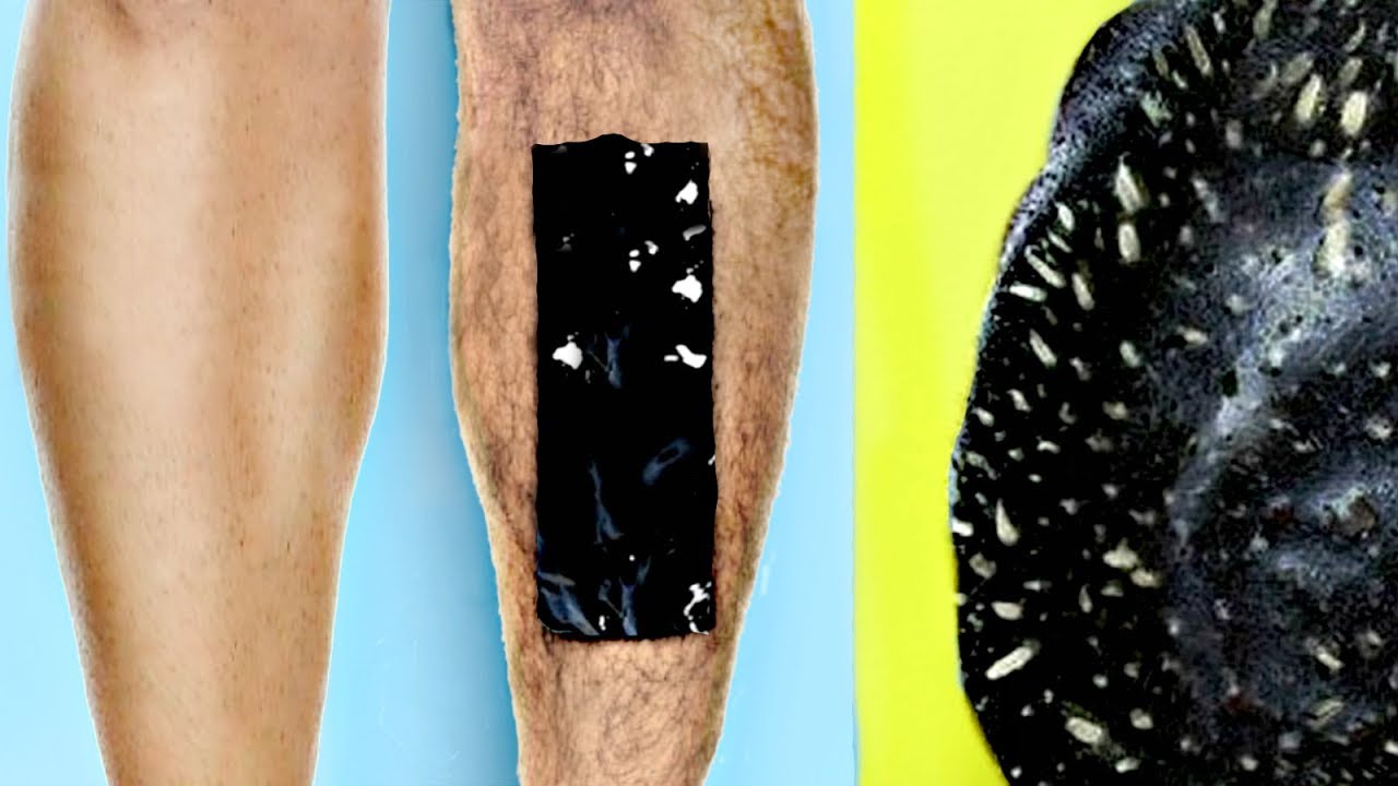 Epic Reactions - MSN