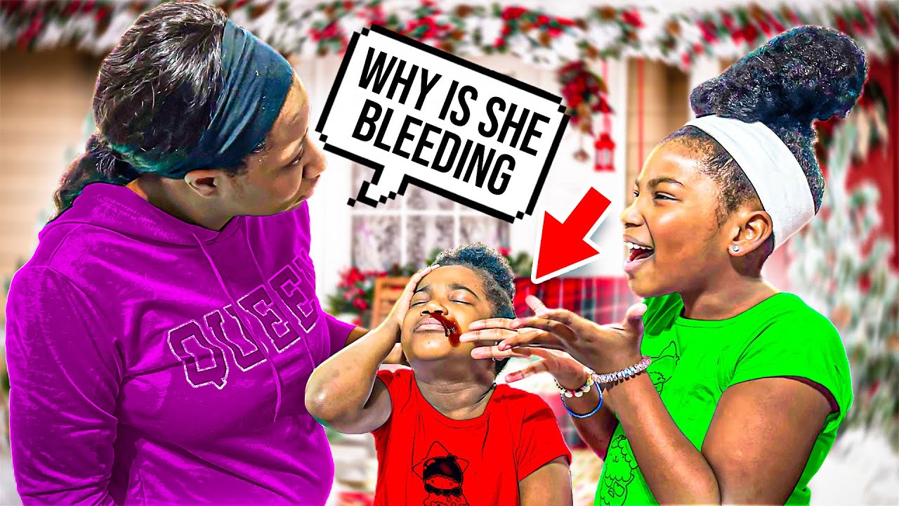 Girl gets a bloody nose: What happens next is shocking
