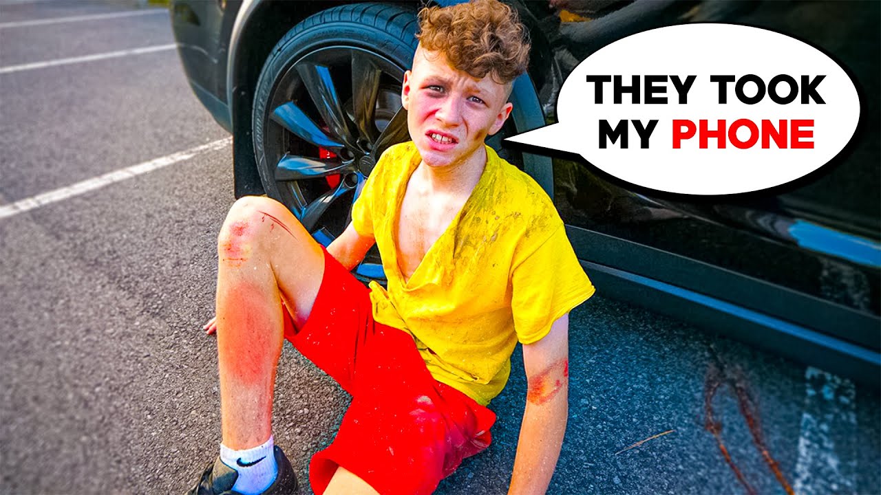 Someone did this to my little brother – shocking