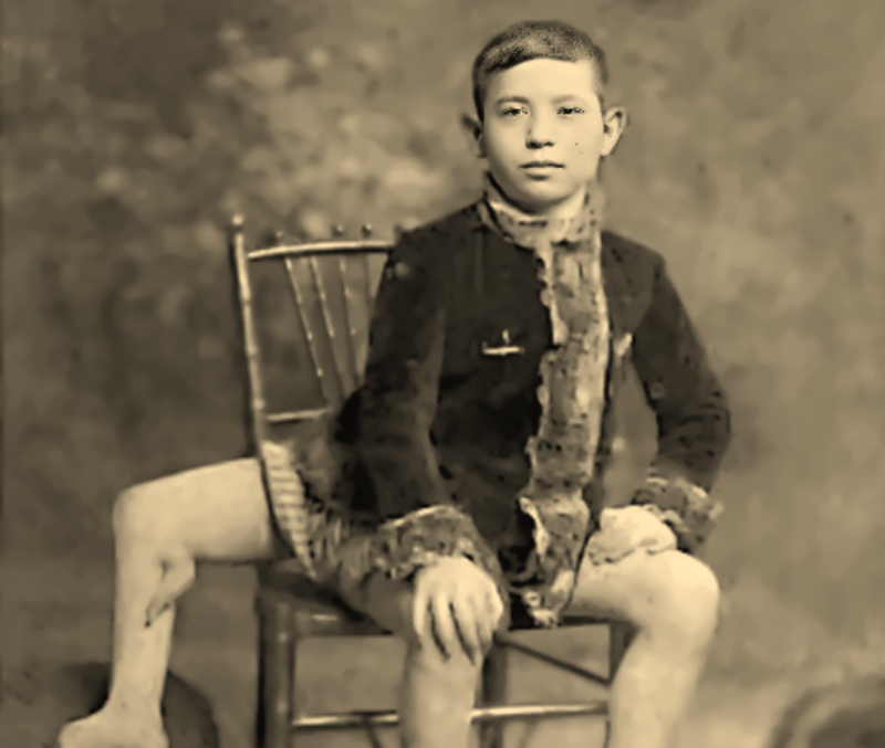 The Extraordinary Life Of The Three-Legged Man