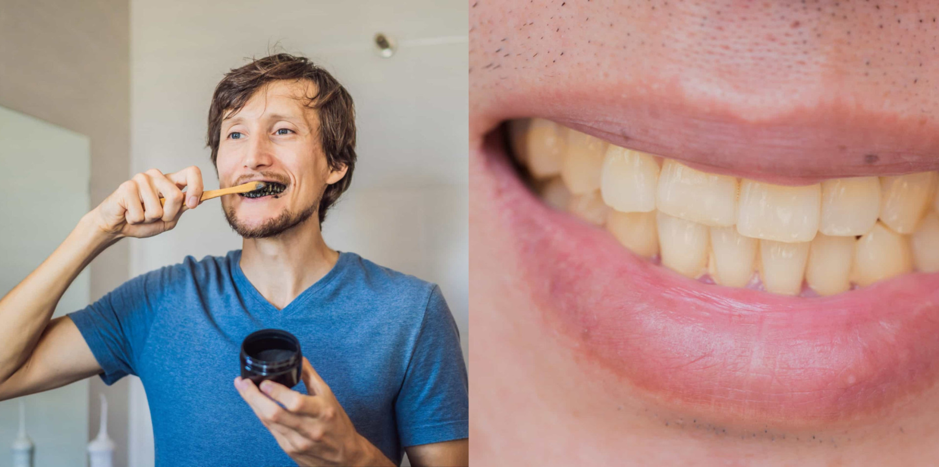 Blanchir ses dents naturellement : ce qui marche vraiment