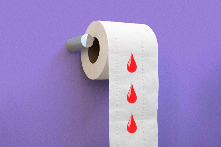 Blood in Stool: Common Causes and Cancer Warning Signs