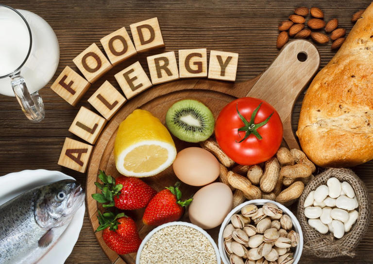 Food Allergies: Testing, Management & Treatment Food Allergies: Testing, Management & Treatment