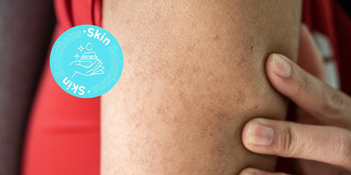 Experts explain how to get rid of those pesky little bumps on the back ... Experts explain how to get rid of those pesky little bumps on the back ...