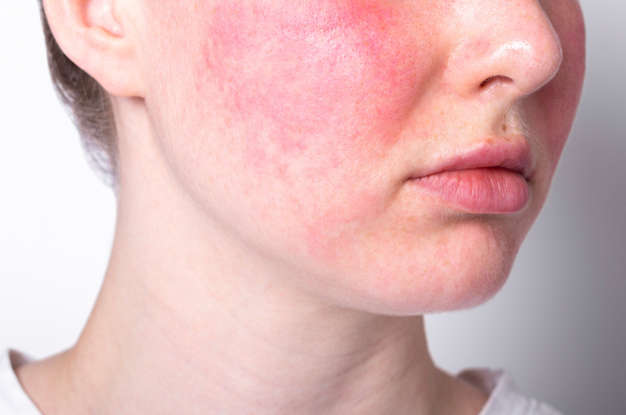 The potential reasons why your face looks swollen The potential reasons why your face looks swollen