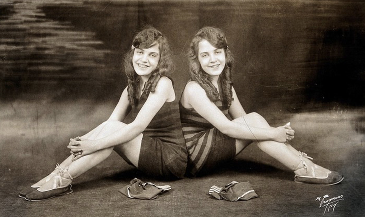 The Tragic Lives of Famous Conjoined Twins Daisy & Violet Hilton