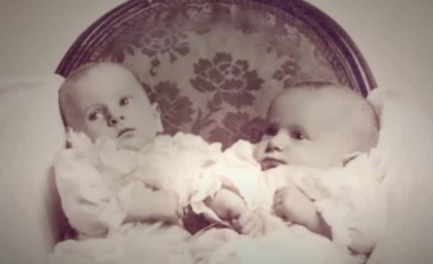 The Tragic Lives of Famous Conjoined Twins Daisy & Violet Hilton