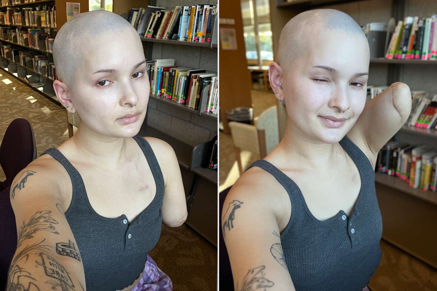 My Rare Cancer Has Recurred 3 Times in 3 Years. At Age 22, I've Learned ...