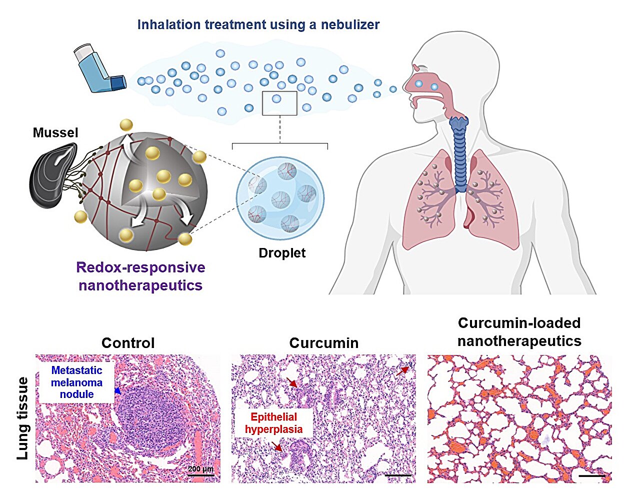 Inhalable therapy uses mussel-inspired nanoparticles to target lung ...
