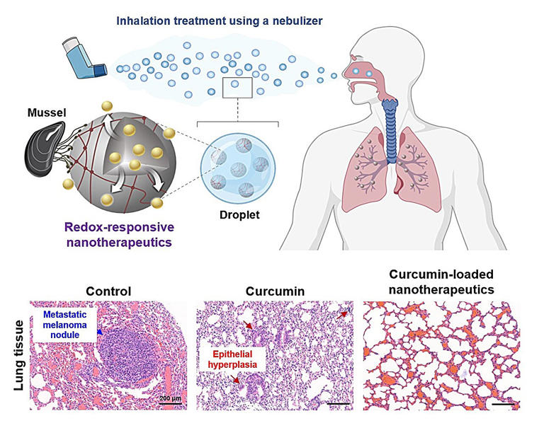 Inhalable therapy uses mussel-inspired nanoparticles to target lung ...