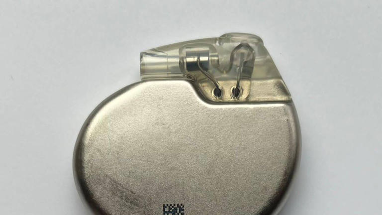 Voor het eerst micro-pacemaker ingeplant bij te vroeg geboren baby in ...