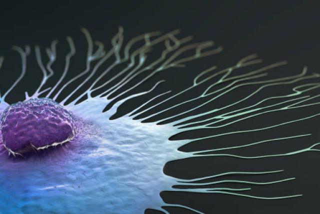 ¿Qué pasa y cuándo se considera que el cáncer no tiene cura?: las ...