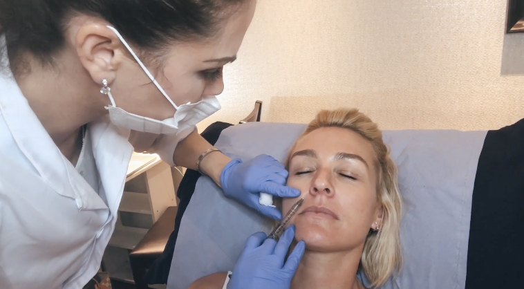 First Filler Experience: Real Talk, Results, and Zero Regrets