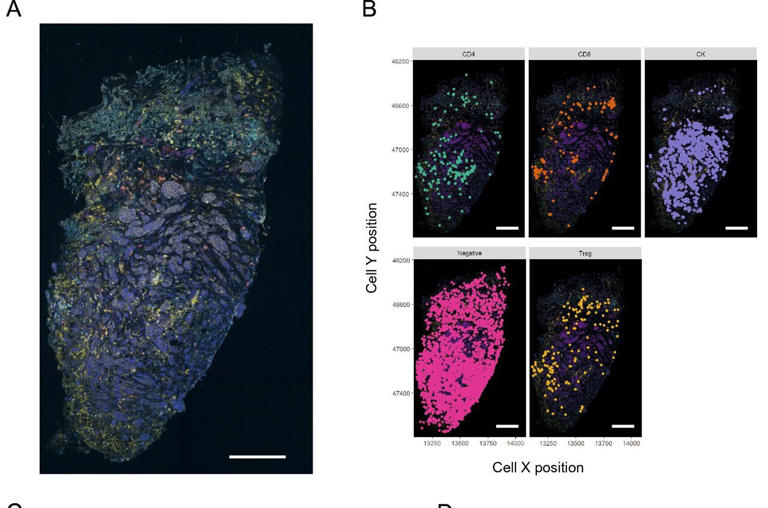 'Explant' technique predicts a tumor's responsiveness to breast cancer ...