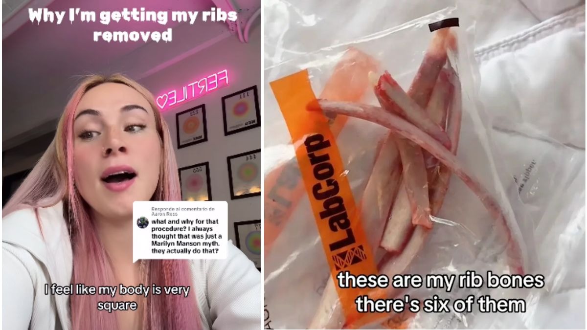 US influencer spends Rs 14 lakh on rib removal, plans to turn bones ...