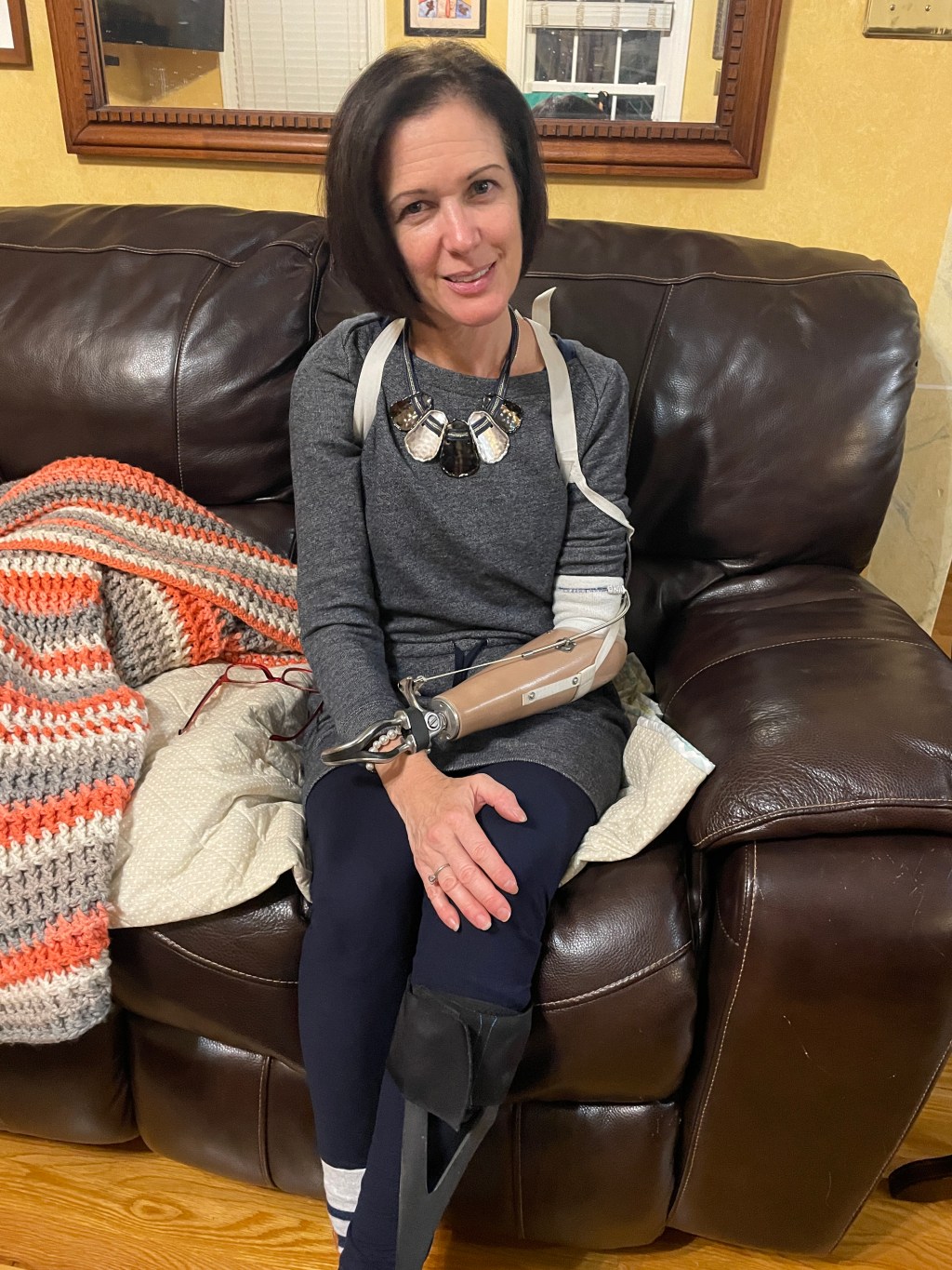 Virginia mom who lost arm in shark attack learns insurance won’t cover ...