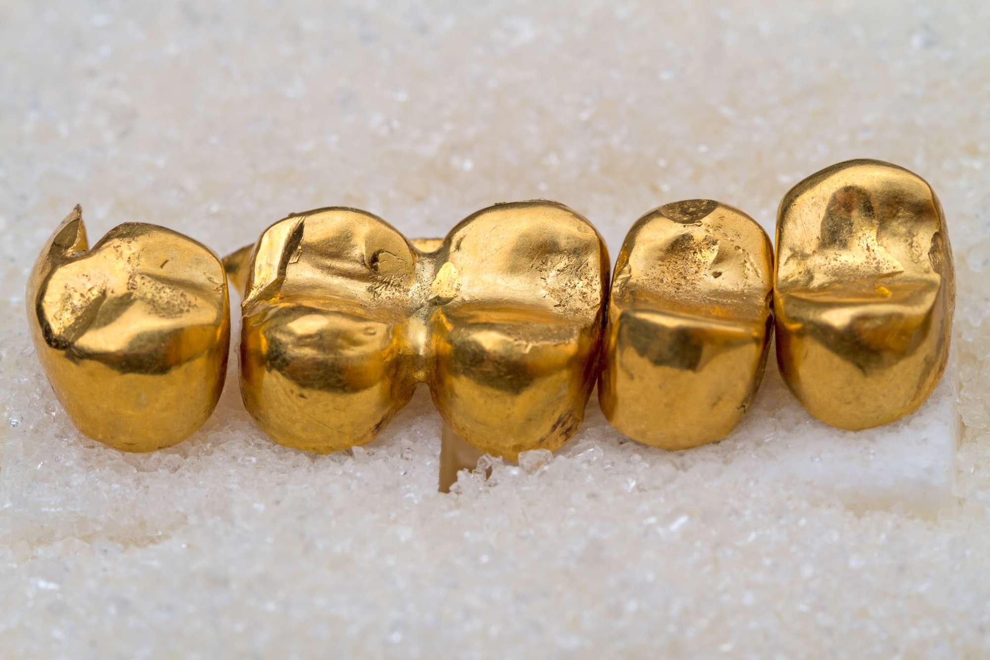 Gold dental crowns