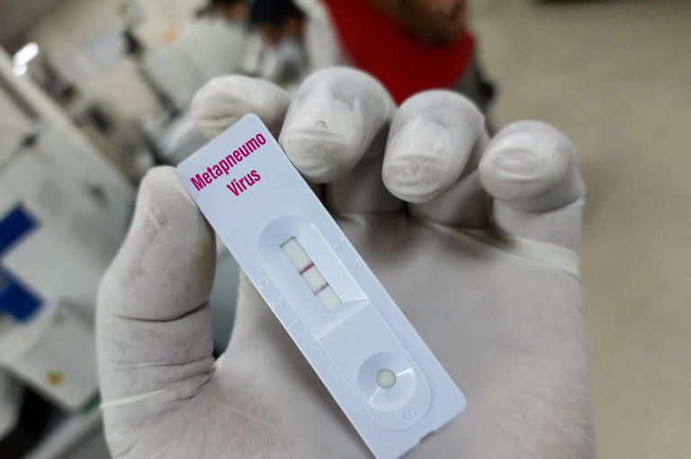 New HMPV warning sign as doctor says check your skin for an unusual change