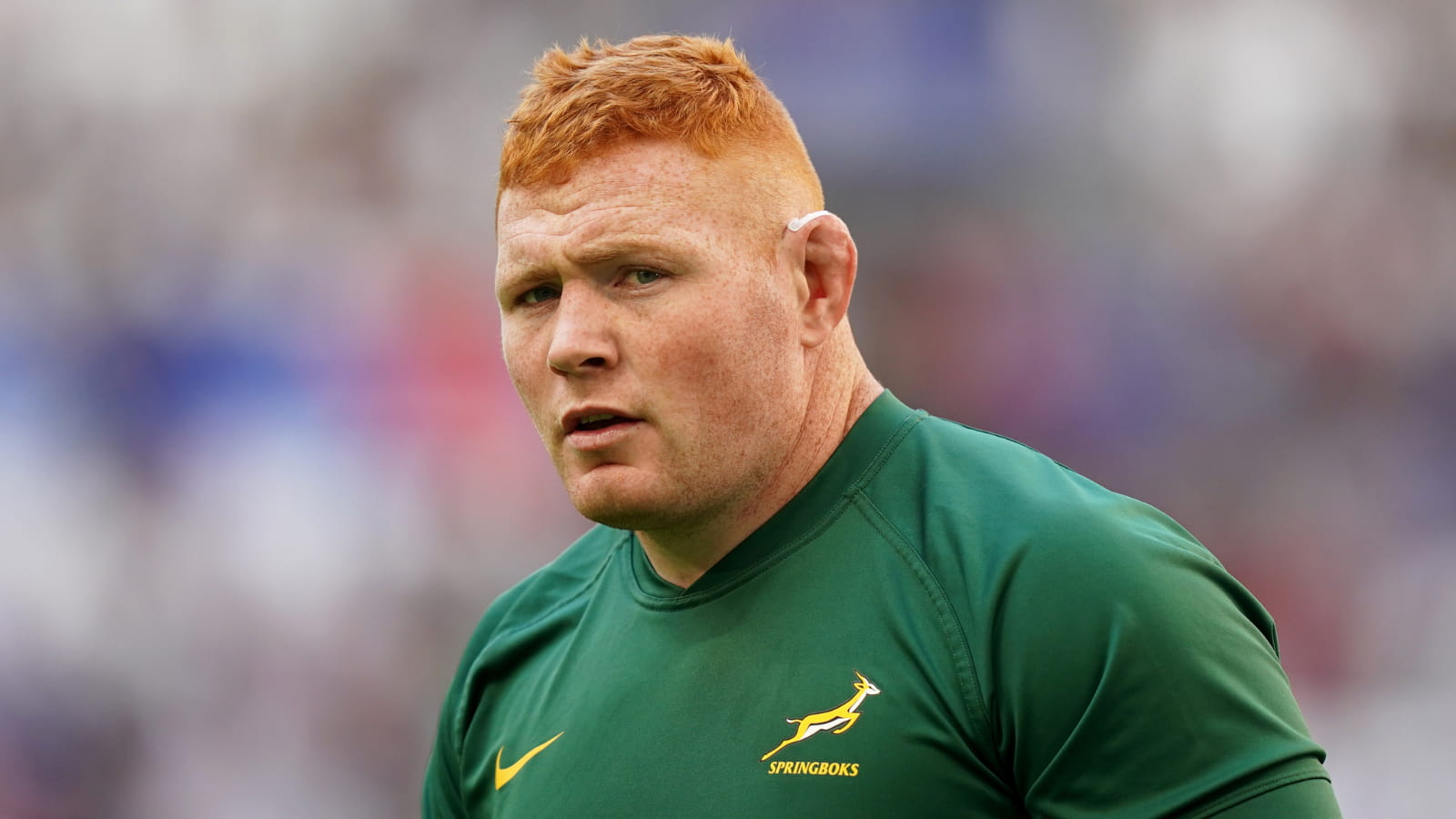 Springboks Rugby World Cup winner who was ‘two millimetres from death ...