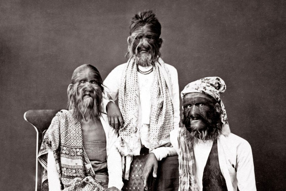 Atavismus: Das Rätsel der Wolfsmenschen: Wenn uralte Gene erwachen