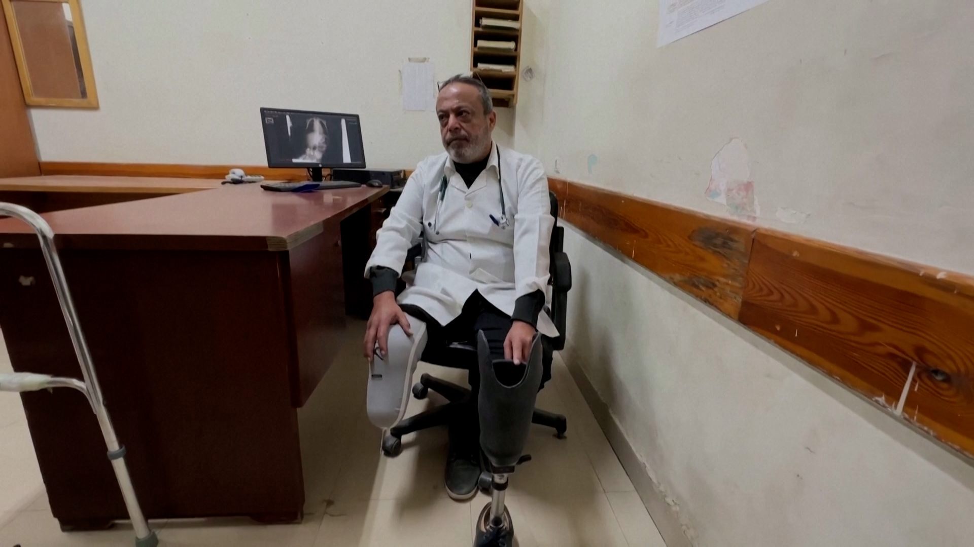 Amputee doctor in Gaza carries on hospital work despite injury