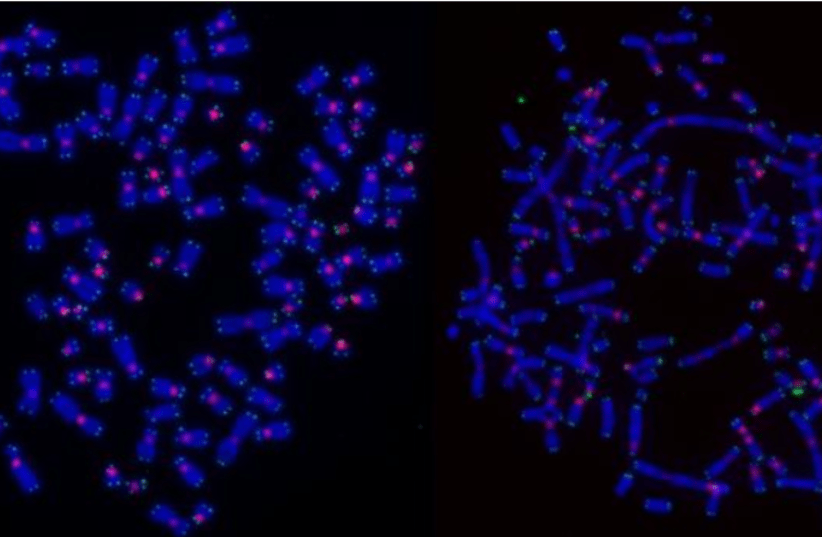 Mystery solved: Researchers find how tumor cells die