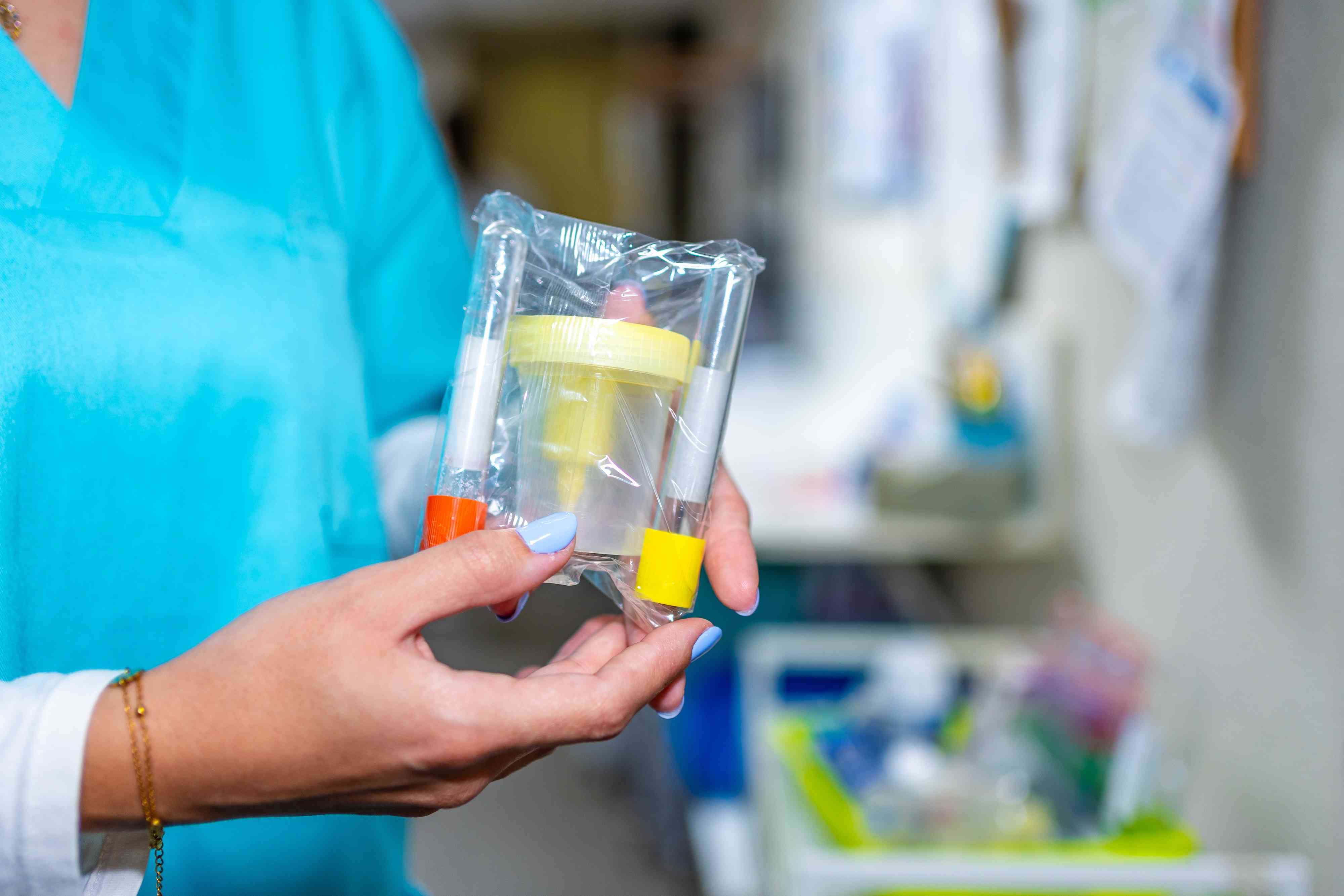 How does alcohol detection work in a urine test?