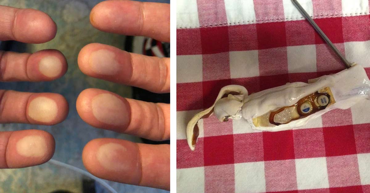 21 people answer the question "What if" in photos