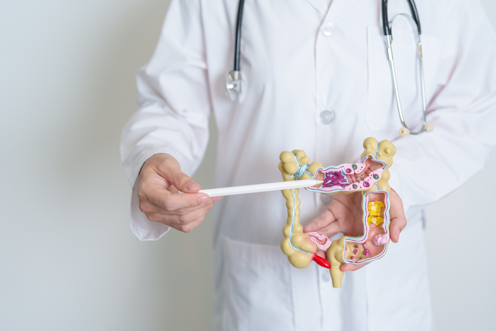 What are the warning signs of colorectal cancer?