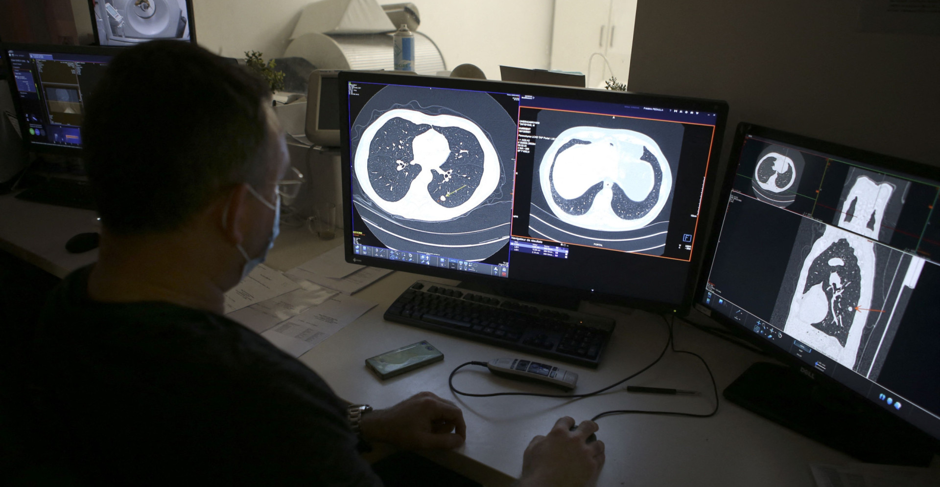 Cancer screening: what tests you should be doing and when